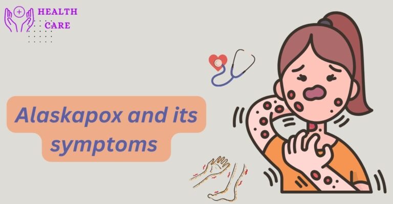 Alaskapox symptoms - This is critical health issue